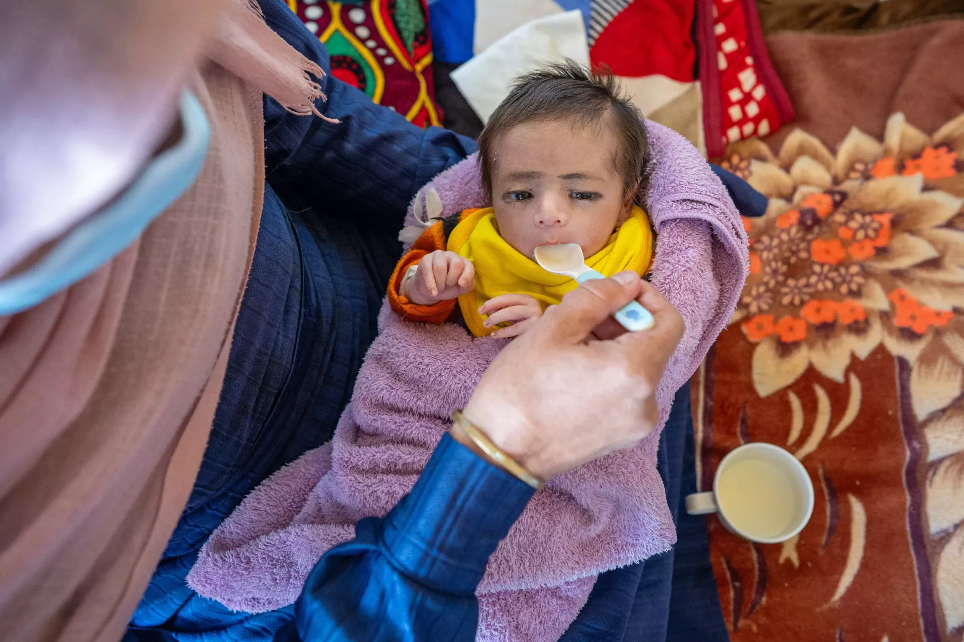 Life-saving therapeutic milk for baby Mustapha | UNICEF Afghanistan