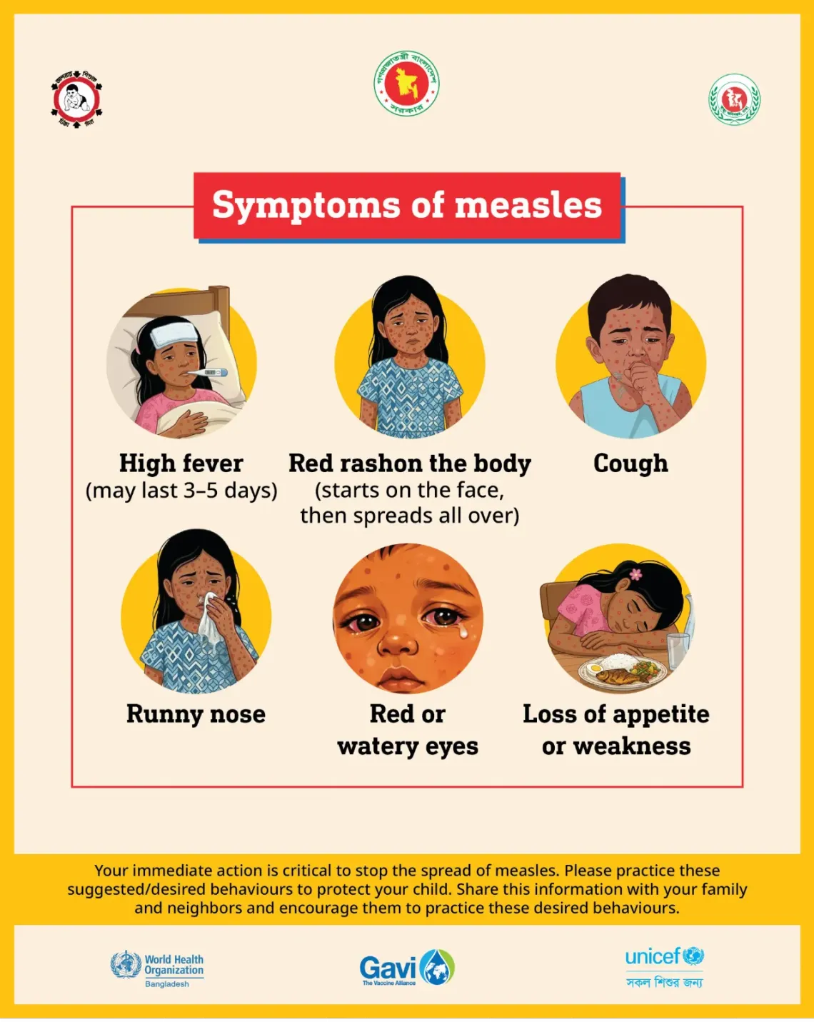 Frequently asked questions about measles in Bangladesh | UNICEF Bangladesh