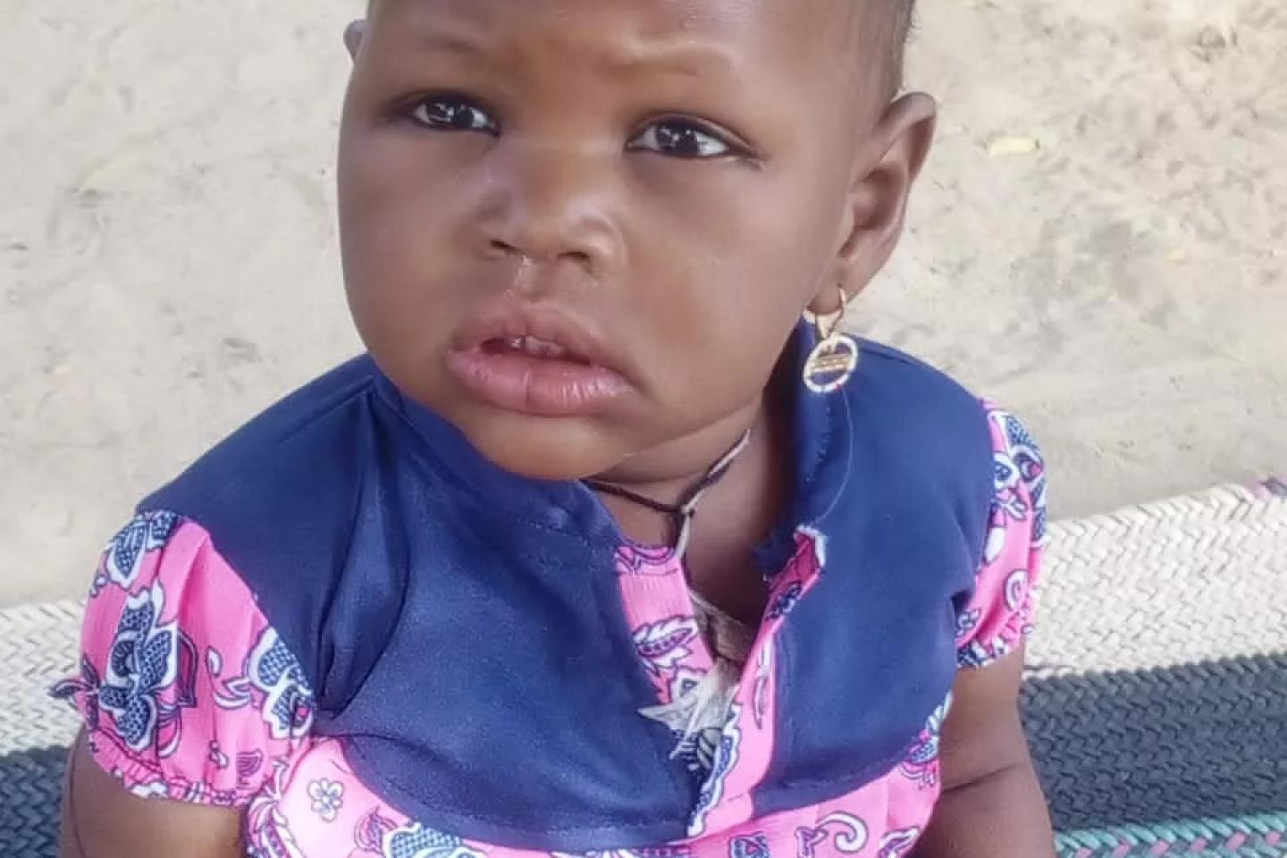 How little Yanoya bounced back | UNICEF Nigeria